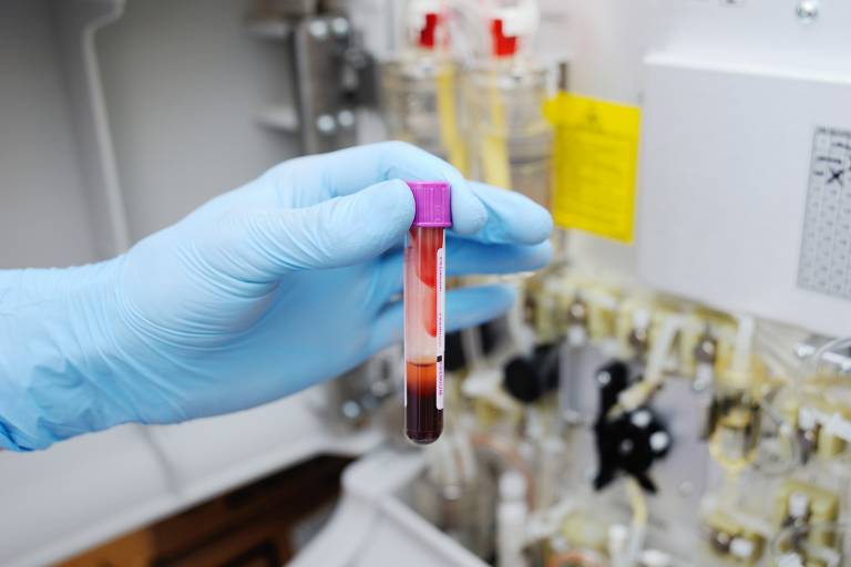 Dieta przy zakażeniu Helicobacter Pylori – produkty zakazane i zalecane ... Dieta przy zakażeniu Helicobacter Pylori – produkty zakazane i zalecane ...